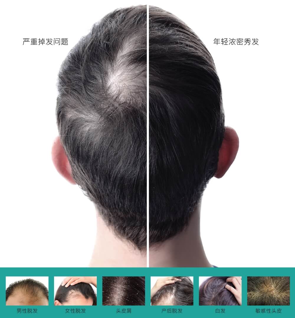 主页 - Hair Doc